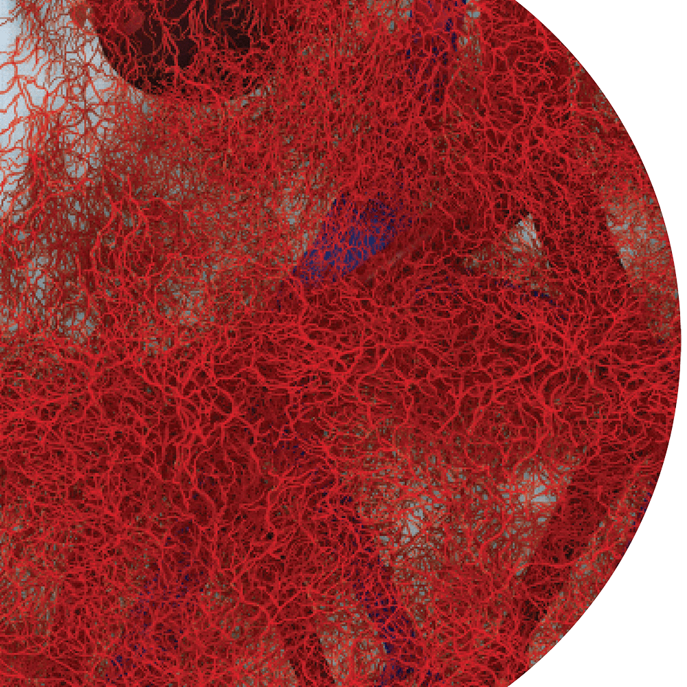 Capillary close-up – Microvascular