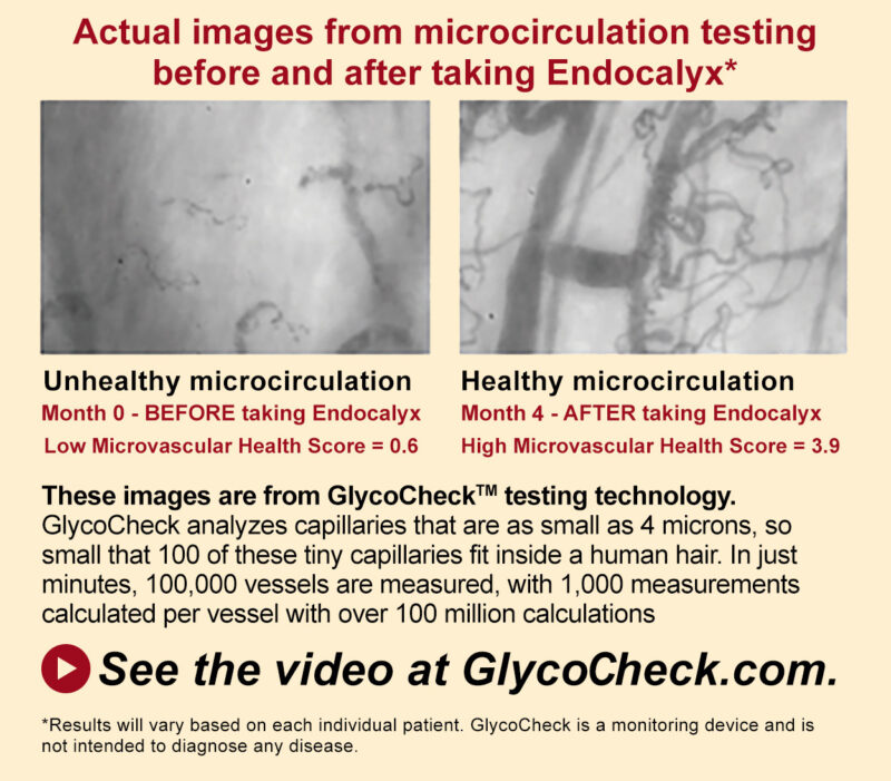 Endocalyx Pro Anti-Aging Supplement – Microvascular