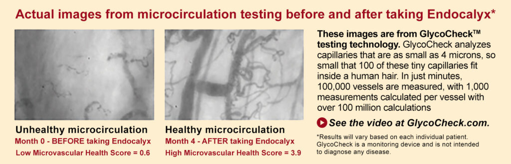 Endocalyx Pro Anti-Aging Supplement – Microvascular