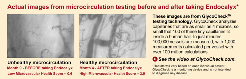 Endocalyx Pro Anti-Aging Supplement – Microvascular