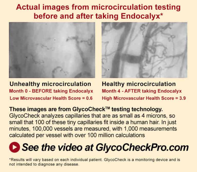 Endocalyx Pro Anti-Aging Supplement – Microvascular