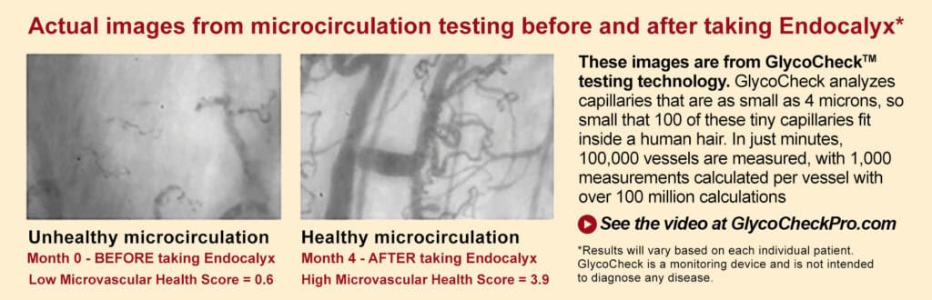 Endocalyx Pro Anti-Aging Supplement – Microvascular