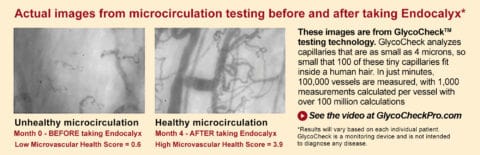 Endocalyx Pro Anti-Aging Supplement – Microvascular